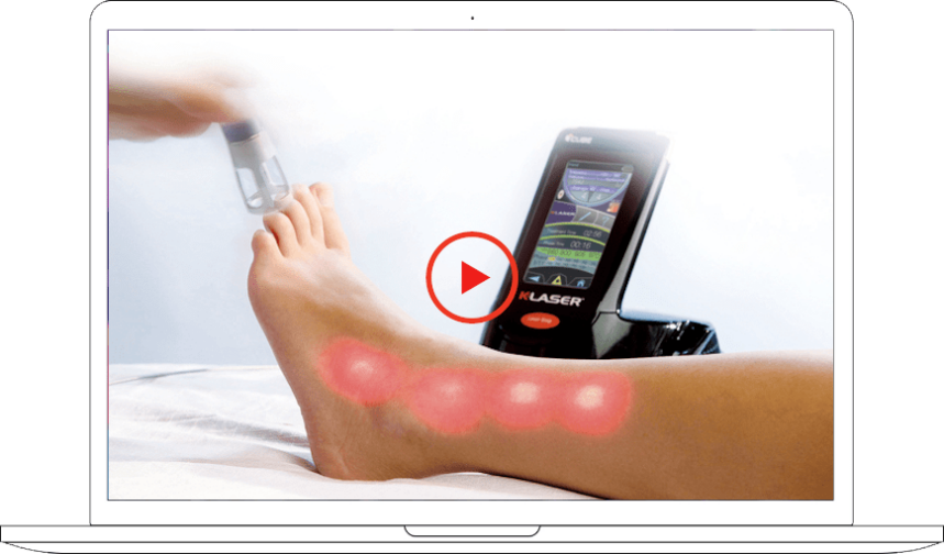 Lasers For Podiatry - K-Laser Australia - Medical | Cosmetic ...